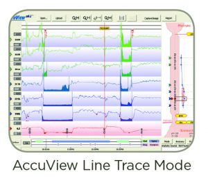 24 Hrs pH-Impedance Monitoring system - SMIT Medical